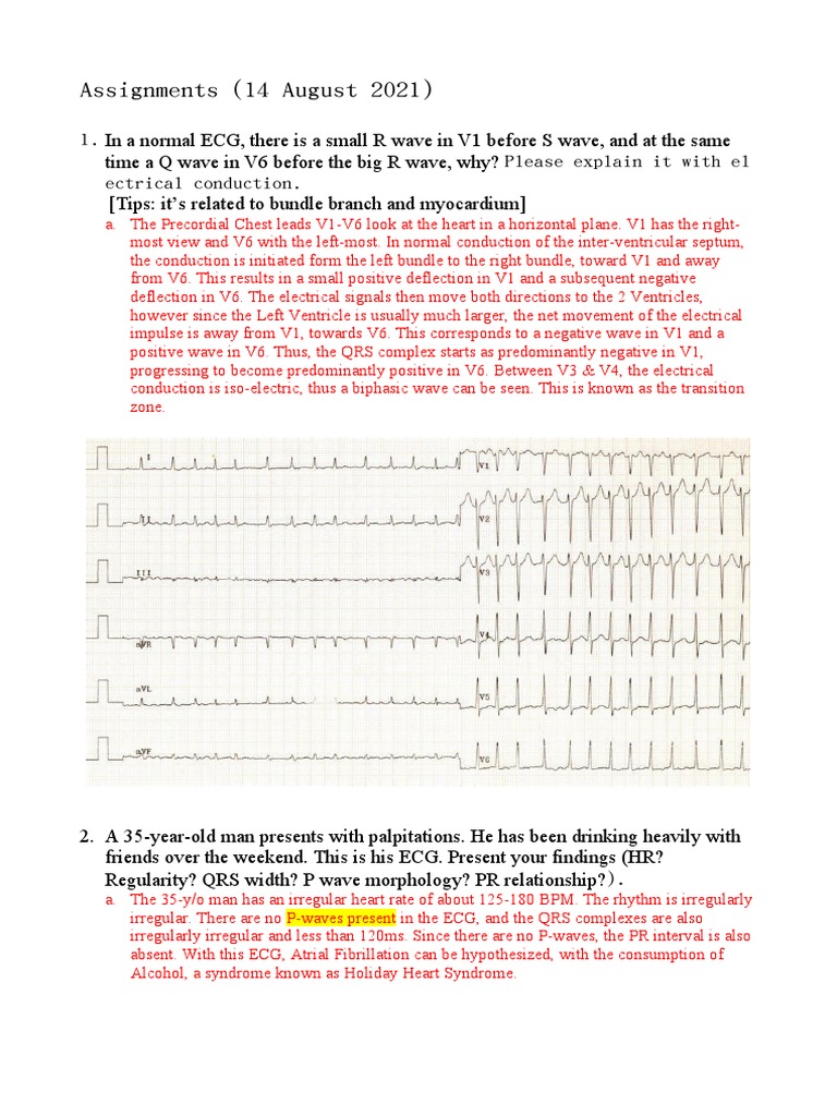 ECG Assignment 1 - Sam Nithish | PDF