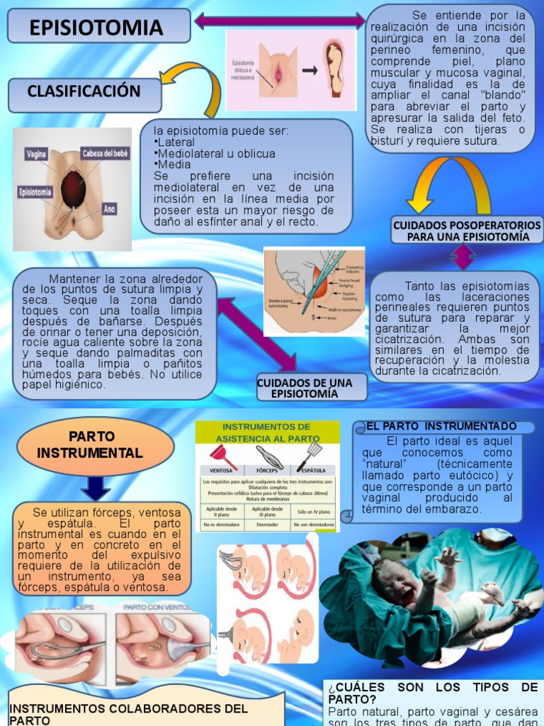 Laminas Episiotomia | Descargar gratis PDF | Parto | Salud pública