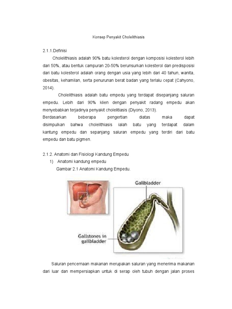 Penyakit Cholelithiasis: Definisi dan Gejala | PDF