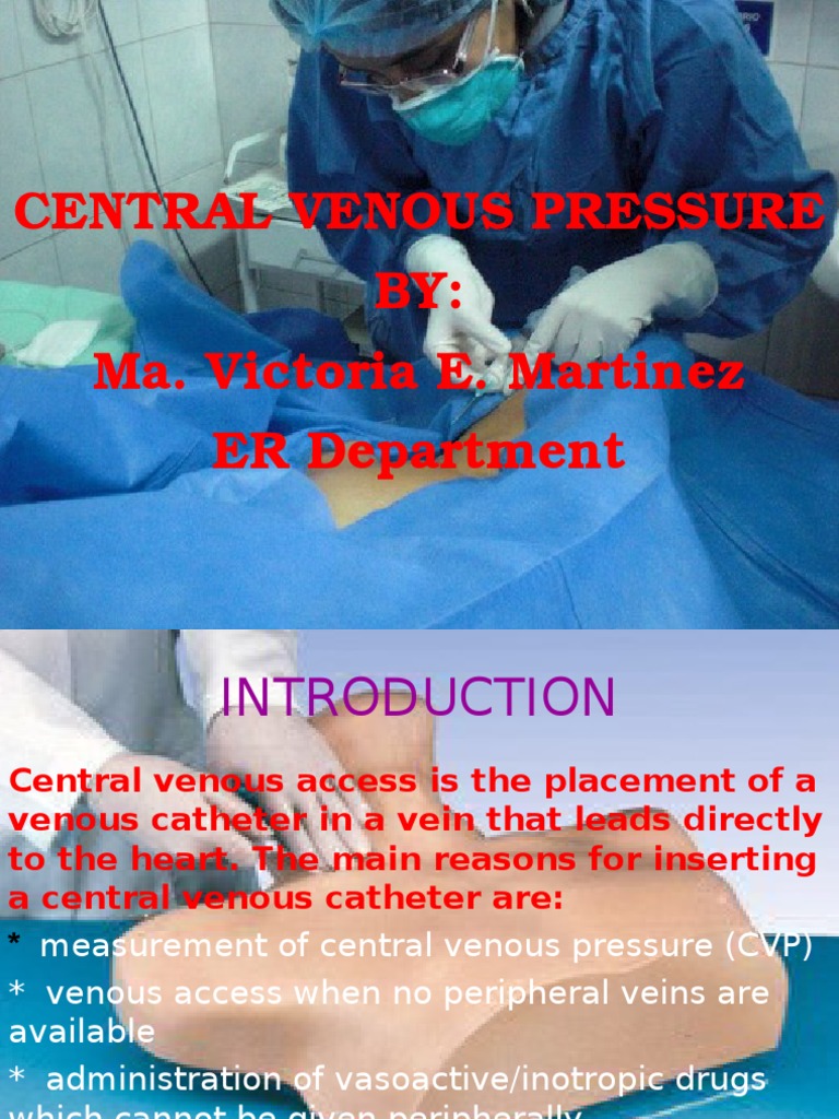 Central Venous Pressure BY: Ma. Victoria E. Martinez ER Department ...