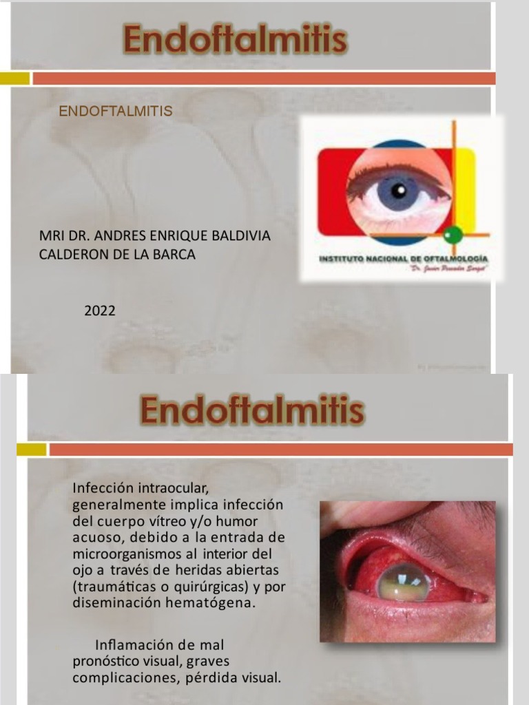Endoftalmitis Presentación Andrés Baldivia MRI OFTALMO | PDF ...