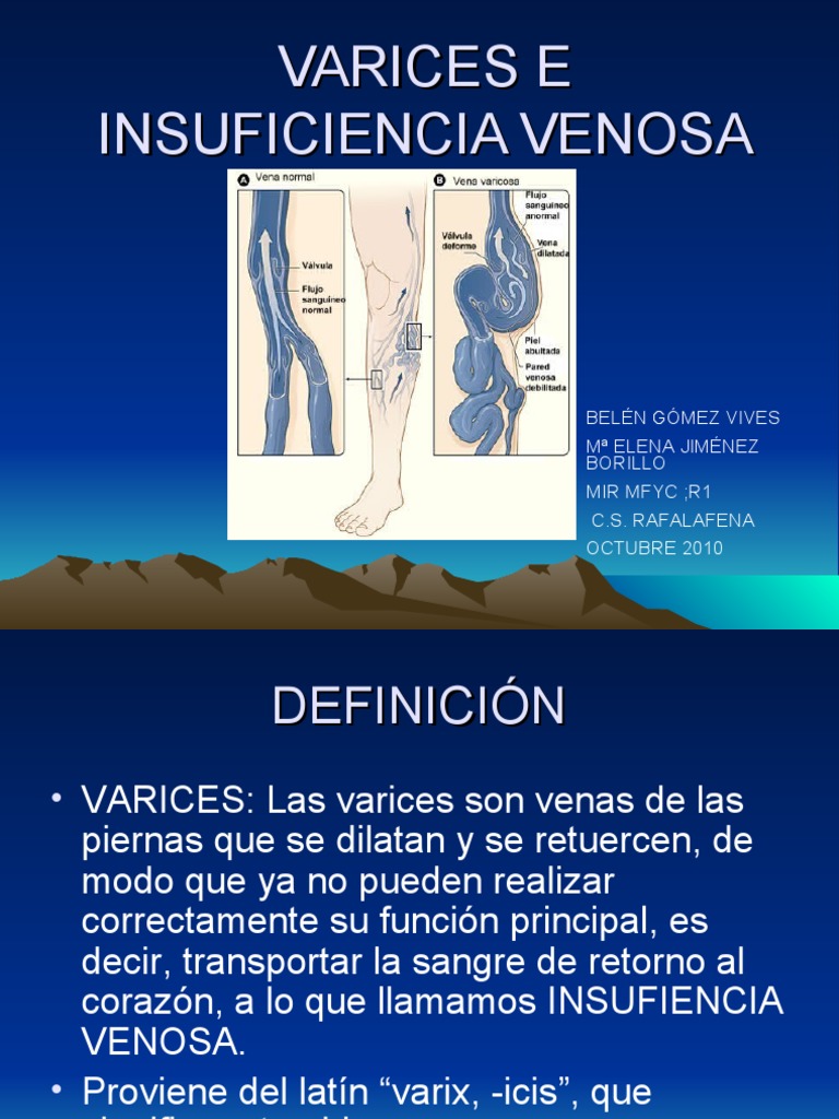 Varices e Insuficiencia Venosa | PDF | Venas varicosas | Epidemiología