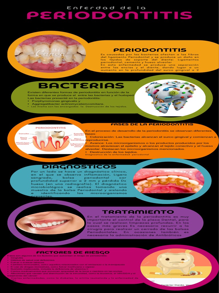 Infografía de La S Enfermedades de La Periodontitis | PDF | Cuidado de ...