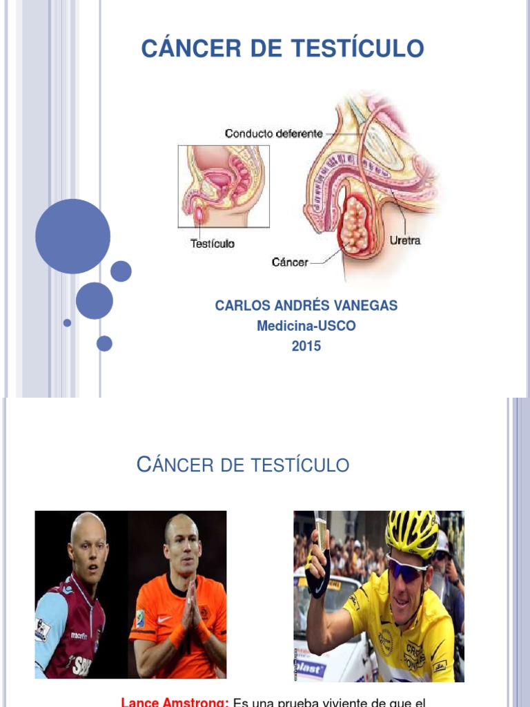 Cáncer de Testículo: Diagnóstico y Tratamiento | PDF | Cáncer | Metástasis