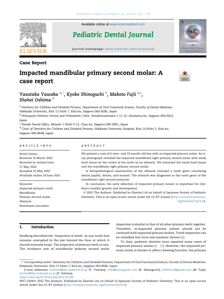 Impacted Mandibular Primary Second Molar A Case Report | PDF | Dental ...