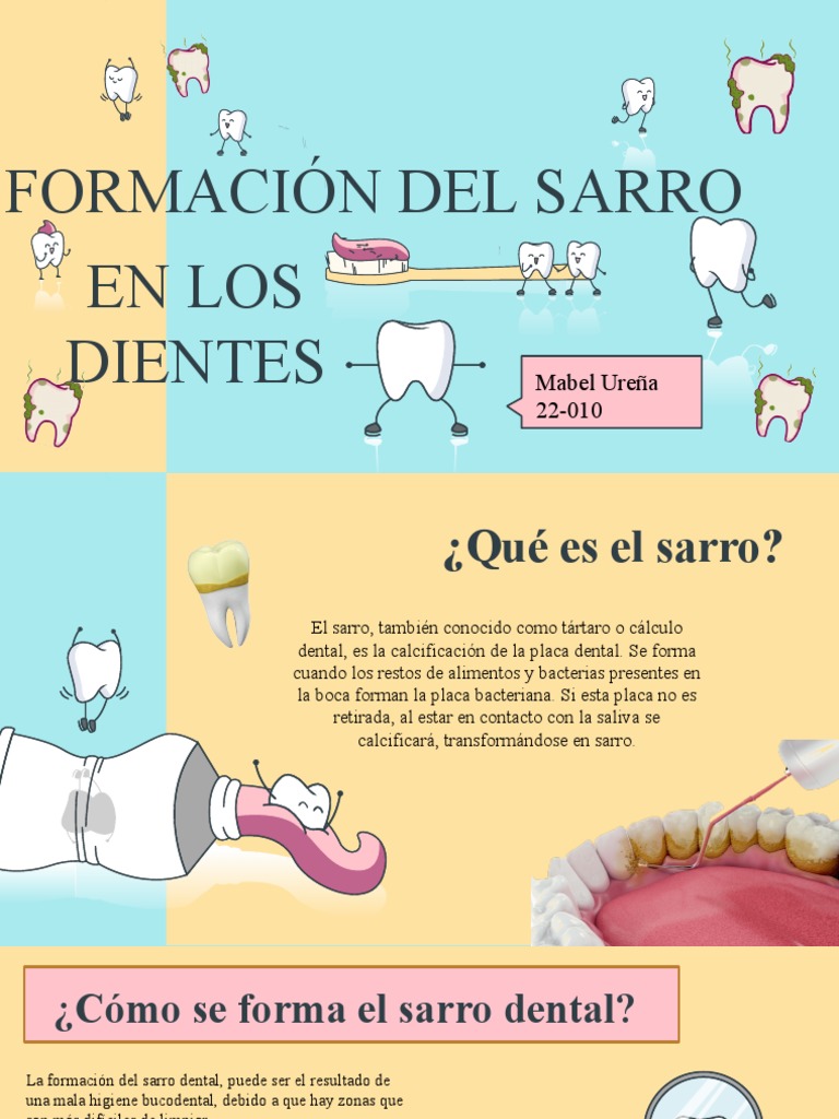Formación Del Sarro en Los Dientes | PDF