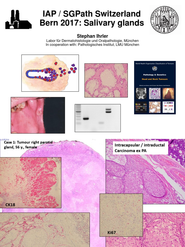 2017 Salivary Glands | PDF | Adenoma | Clinical Medicine