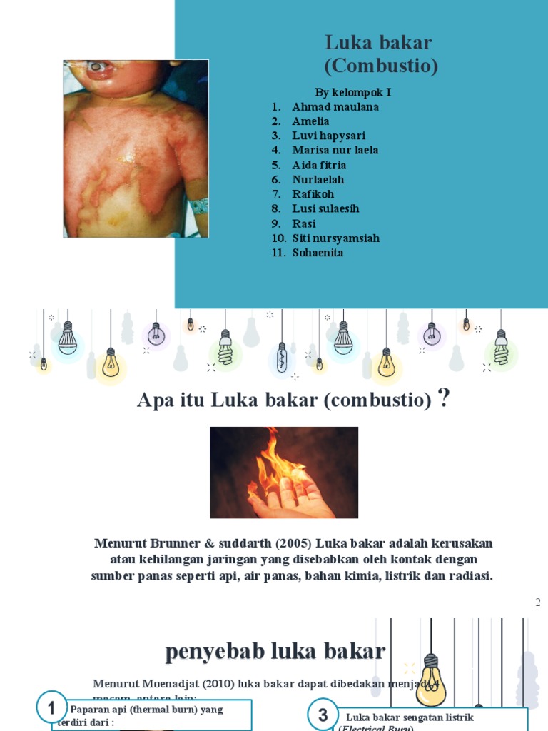 Makalah Luka Bakar | PDF