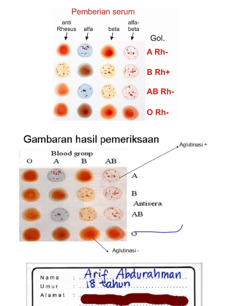 Hasil Cek Golongan Darah | PDF