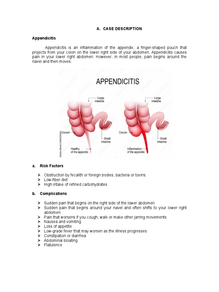 Acute Appendicitis Group C | PDF | Surgery | Gastrointestinal Tract