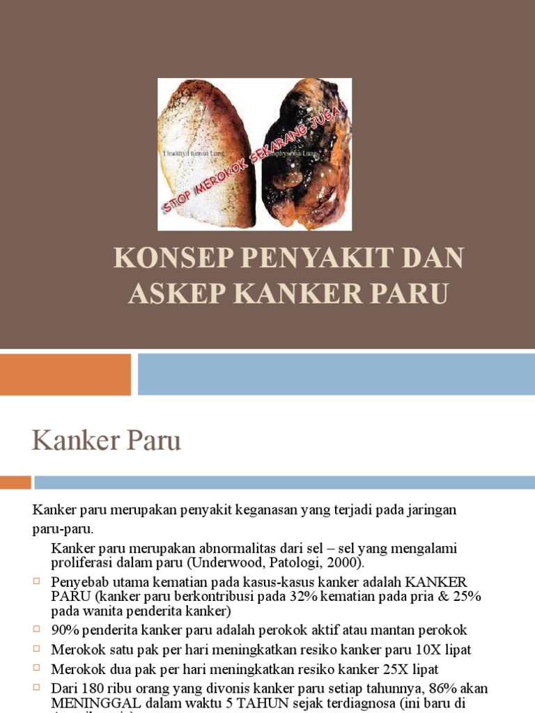 PPT kanker paru | PDF