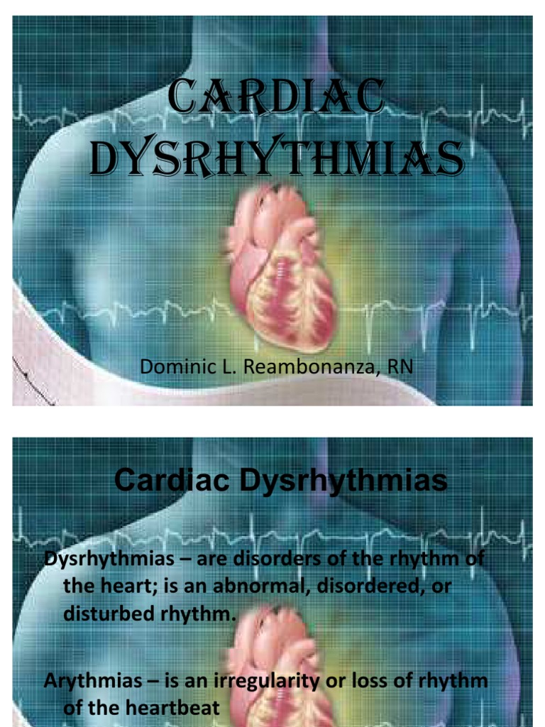 Cardiac Dysrhythmias | PDF | Cardiac Arrhythmia | Artificial Cardiac ...