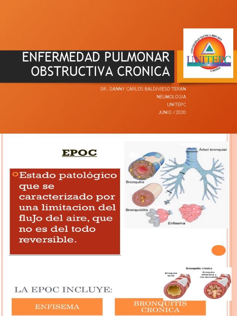 EPOC | PDF