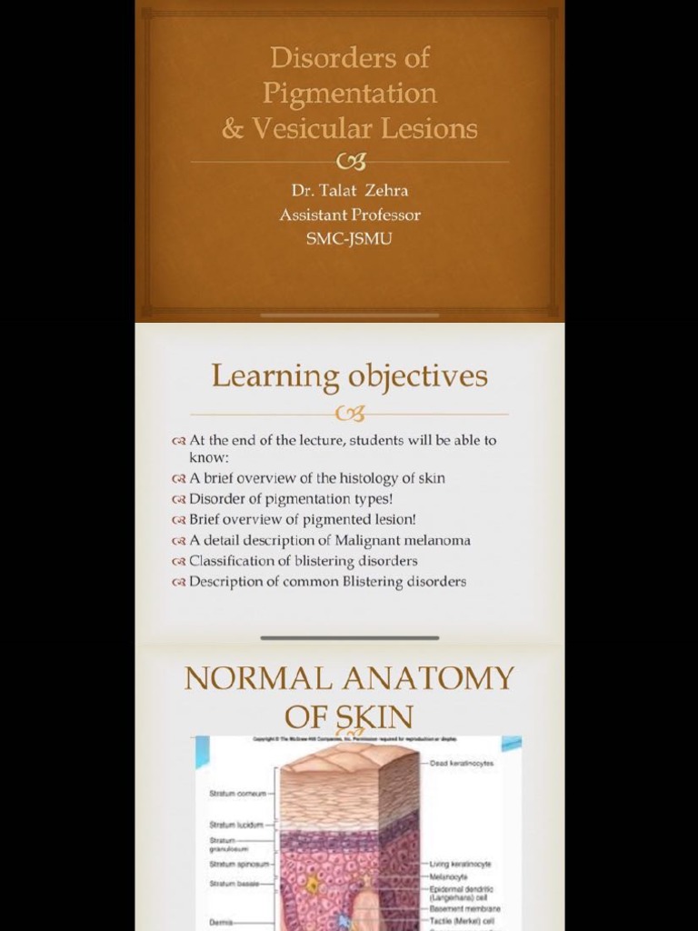 Disorders of Pigmentation, Vesicular Diseases | PDF