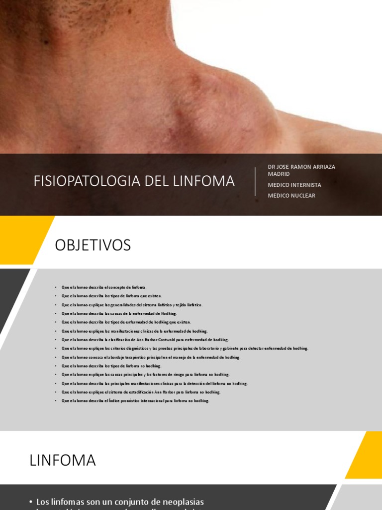 Fisiopatología de los linfomas | PDF | Linfoma | Sistema linfático