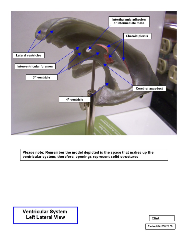 Ventricular System Left Lateral View: Interthalamic Adhesion or ...