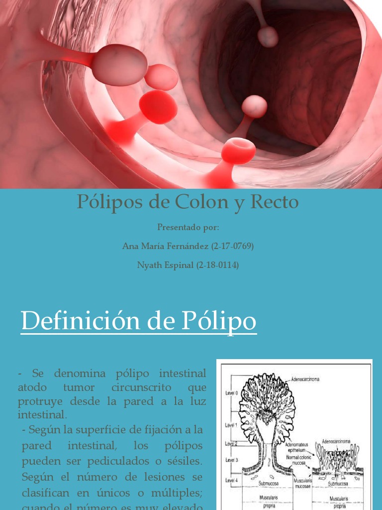 Pólipos de Colón y Recto | PDF