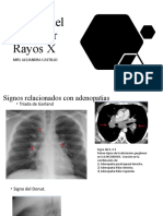 Guía de Signos Radiológicos de Tórax | PDF | Pulmón | Neumonía