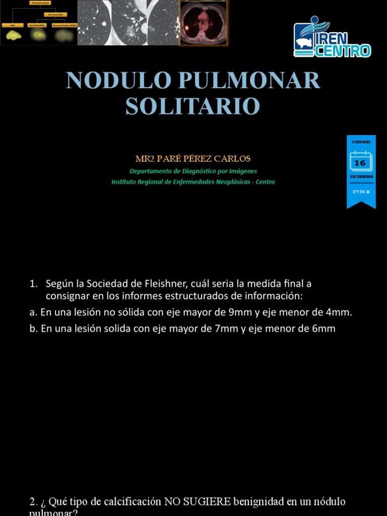 Nódulo Pulmonar Solitario | PDF