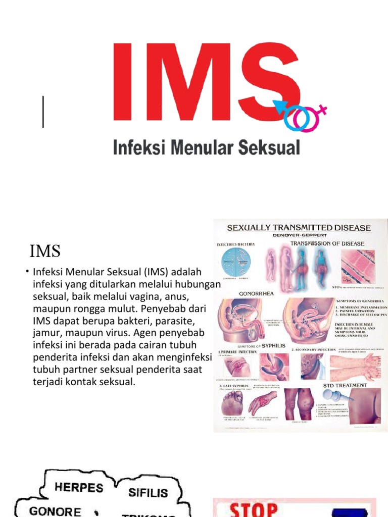 Ims | PDF