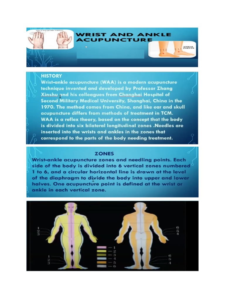 Wrist-Ankle Acupuncture: A Guide to Needling the Wrist and Ankle Points ...