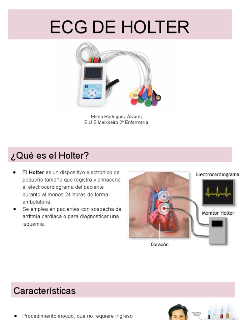 Ecg de Holter | PDF