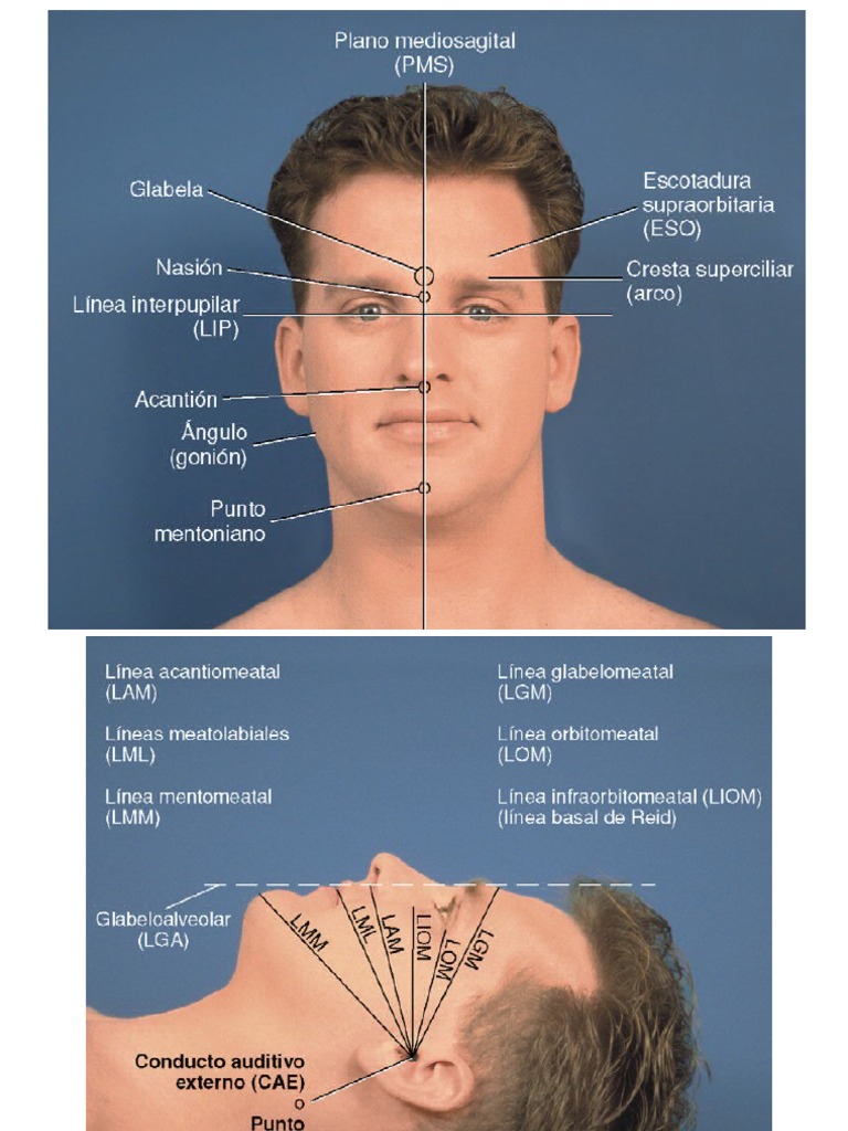 Puntos y Lineas Del Craneo | PDF