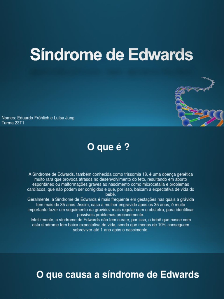 Síndrome de Edwards | PDF