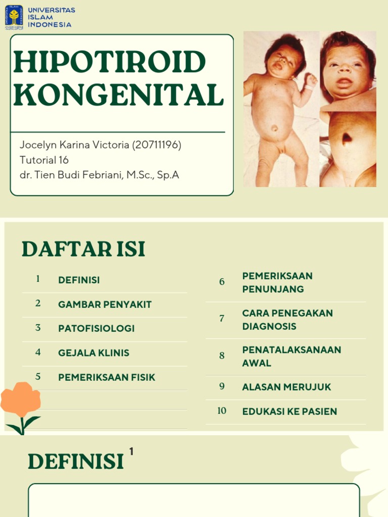 Hipotiroid Kongenital | PDF