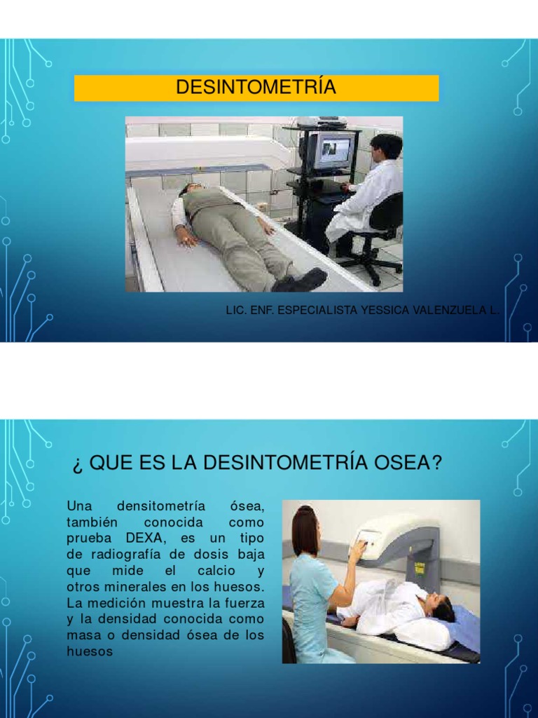 Densitometría Ósea: Guía Completa | PDF | Osteoporosis | Cuidado de la ...