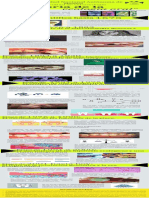 Triada de Keyes en Caries Dental | PDF | Las bacterias | Diente