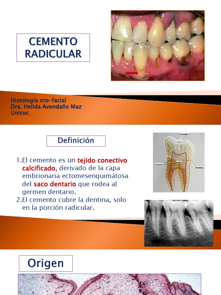 Histología del cemento dental radicular | PDF | Esmalte de dientes ...