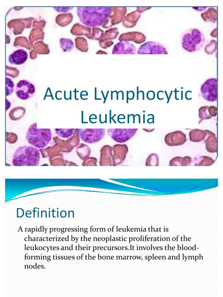 Acute Lymphocytic Leukemia Final | PDF | Leukemia | Bone Marrow