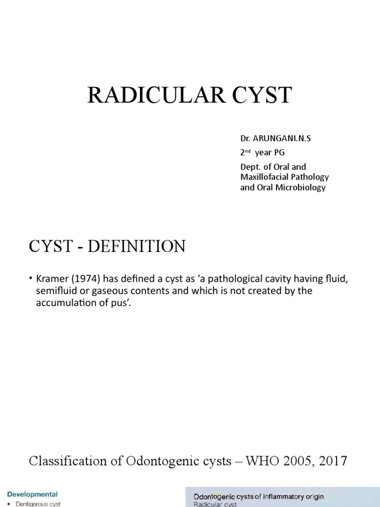 Radicular Cyst Pathogenesis: A Comprehensive Review of the Formation ...