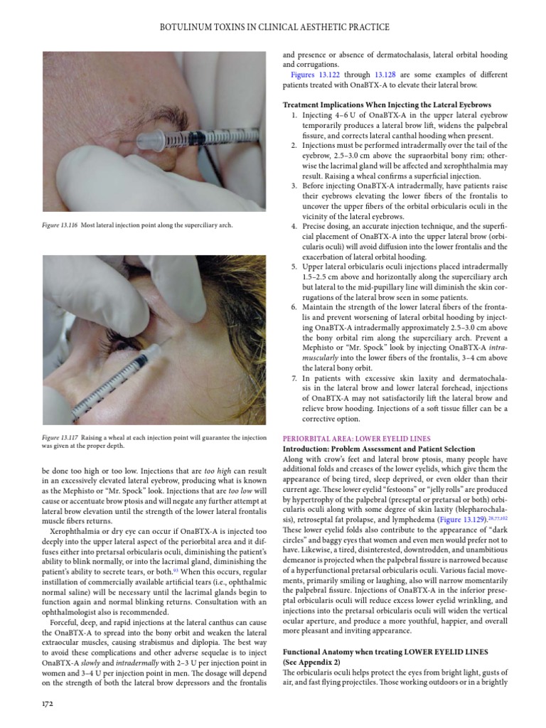 Botulinum Toxins in Clinical Aesthetic Practice: Treatment Implications When Injecting The ...