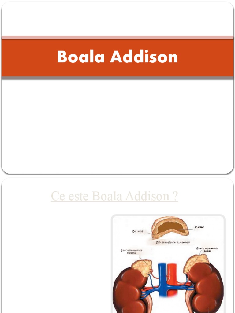 Boala Addison | PDF