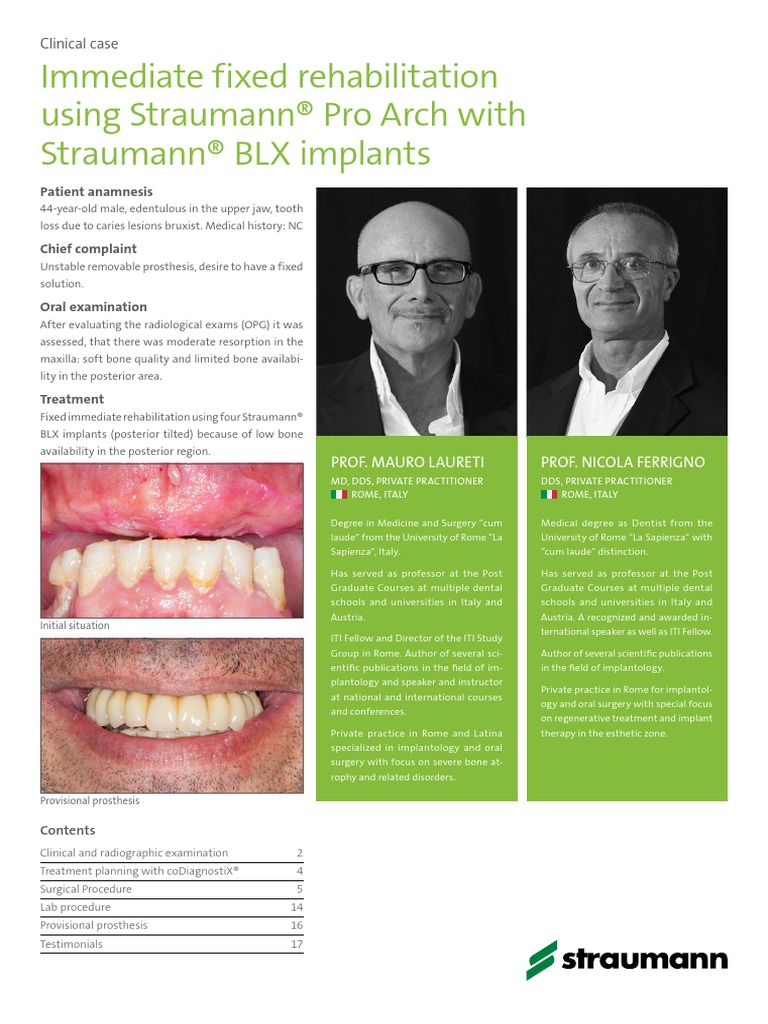 Immediate Fixed Rehabilitation Using Straumann® Pro Arch With Straumann ...