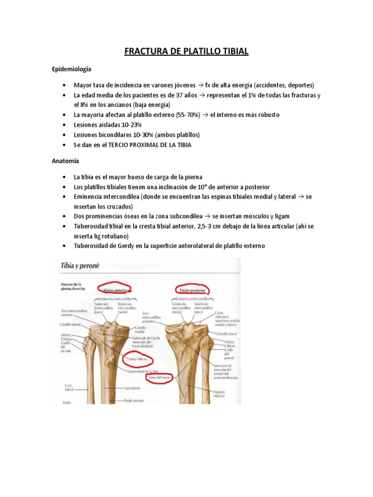 Fractura de Platillo Tibial: Anatomía y Clasificación | PDF | Rodilla ...