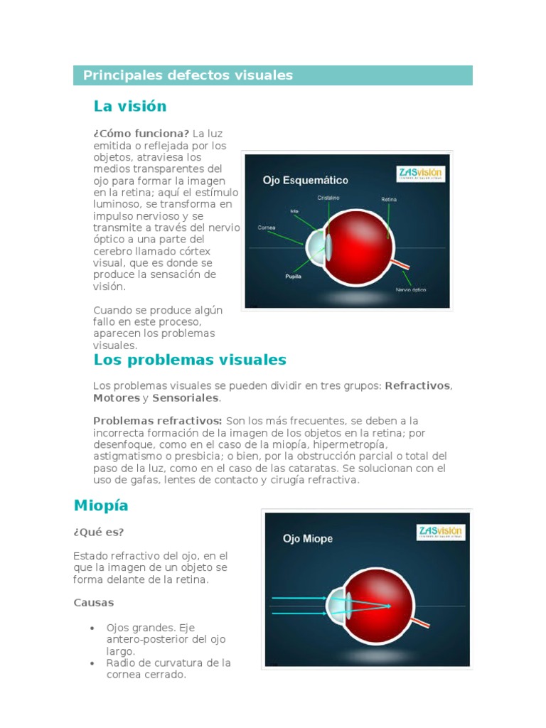 Defectos Visuales y Soluciones Comunes | PDF | Ojo humano | Percepción ...