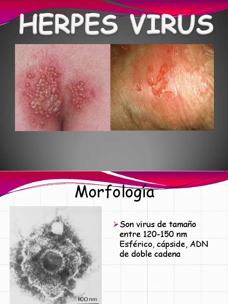 Morfología y Tratamiento de Herpesvirus | PDF