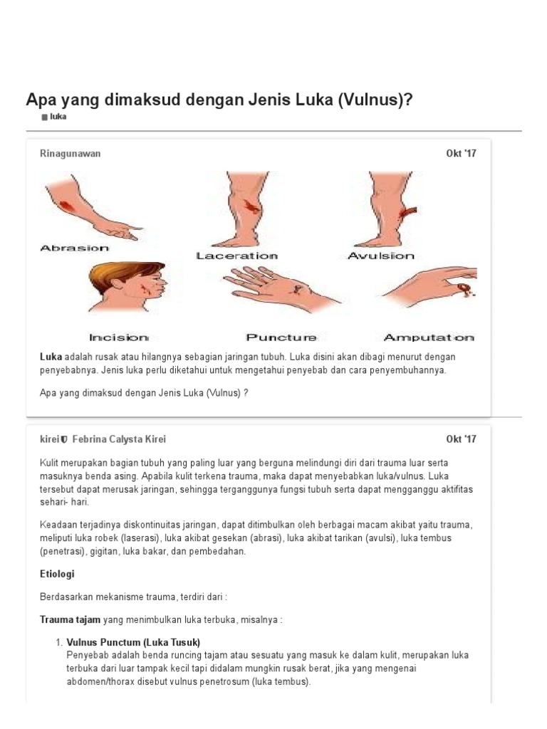 Apa Yang Dimaksud Dengan Jenis Luka (Vulnus) - Kedokteran - Ilmu ...