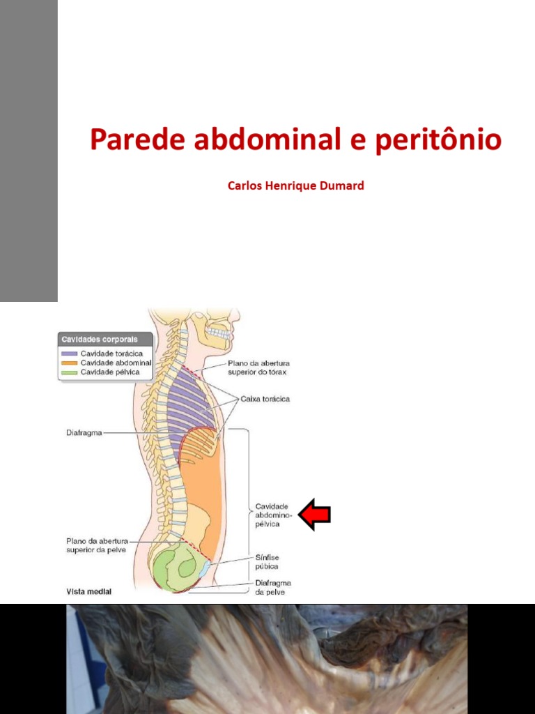 Parede Abdominal e Peritônio | PDF | Anatomia humana | Órgão (anatomia)