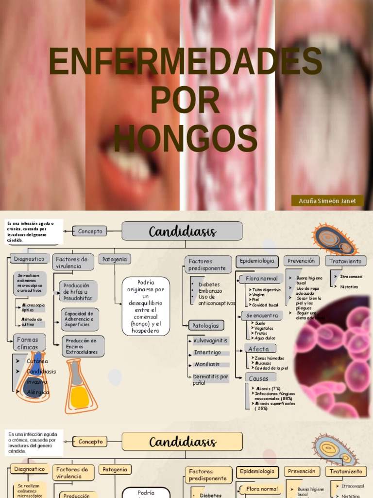 Iguiy | PDF | Candidiasis | Hongo