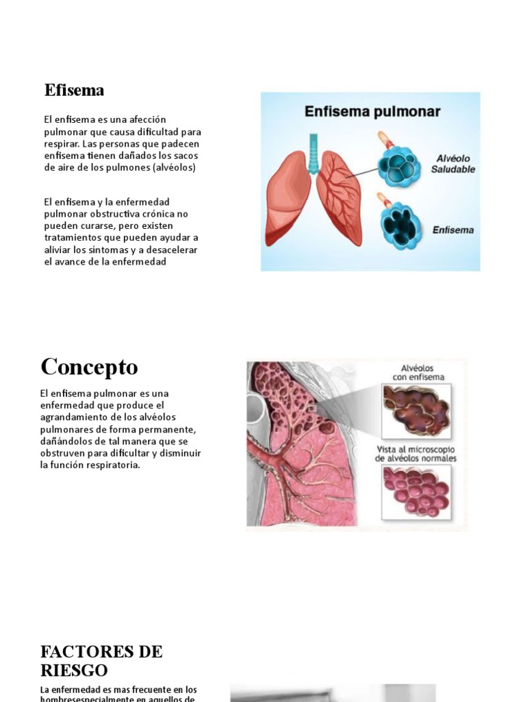 Efisema | PDF | Medicina CLINICA | Enfermedades y trastornos