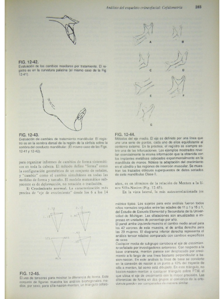 MOYERS Manual de Ortodoncia - Moyers 2 | PDF