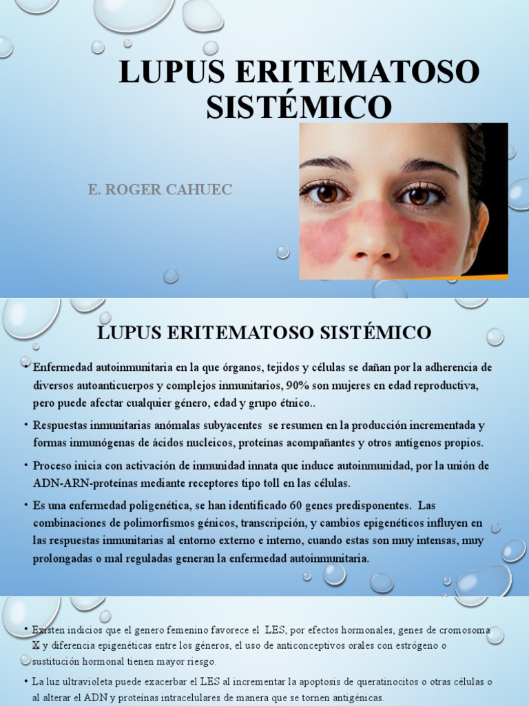 Lupus Eritematoso Sistémico | PDF | Sistema inmune | Enfermedad autoinmune