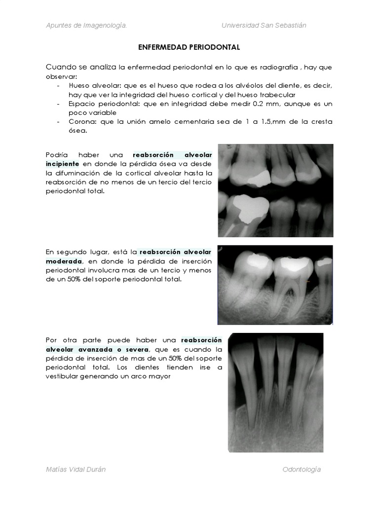 Enfermedad Periodontal | PDF | Ciencias de la Salud | Medicina CLINICA