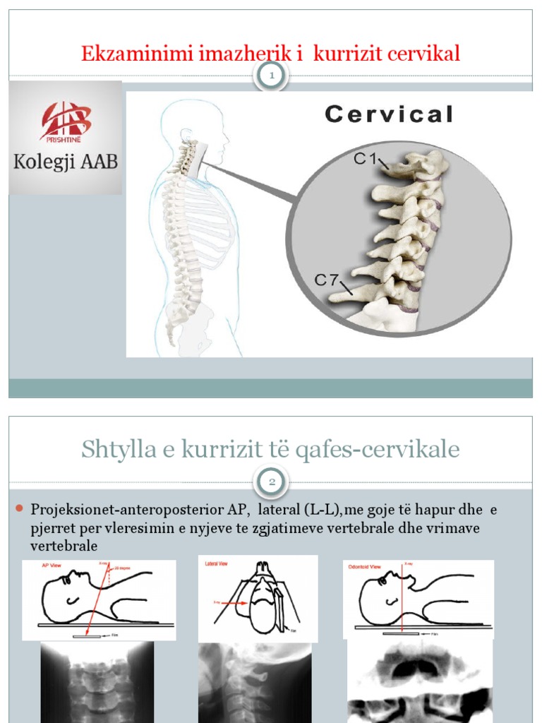 Ekzaminimi Imazherik I Kurrizit Cervikal | PDF