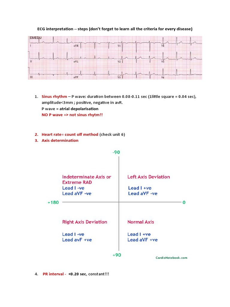 ECG Interpretation | PDF