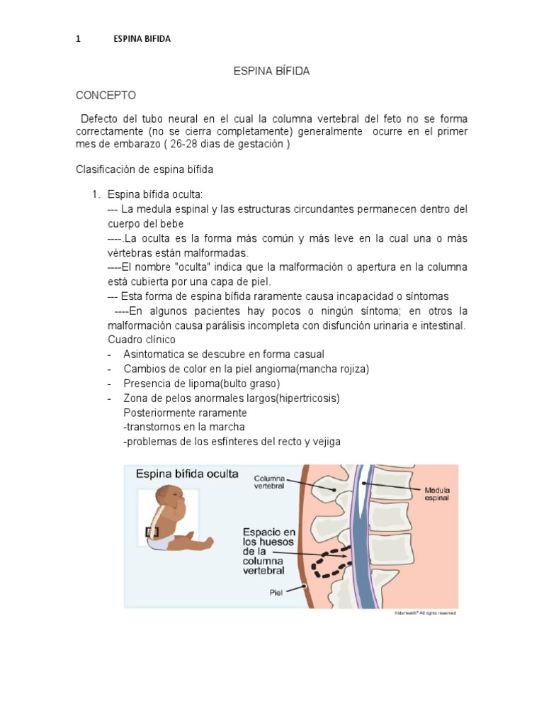 Espina Bifida | PDF | Especialidades Medicas | Ciencias de la Salud